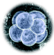 SRMS Media Center | Dr. Sweet, Fertility, IVF